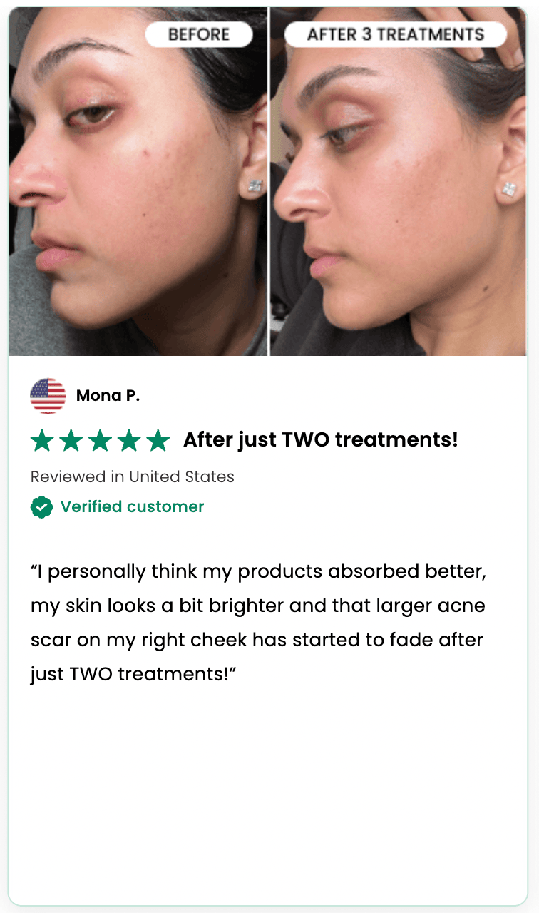 Top 5 Best Wrinkle Creams of 2023 - [Ranked & Reviewed]